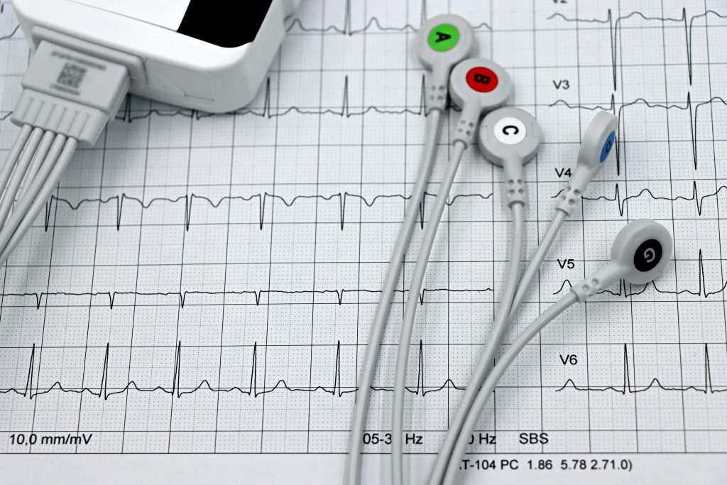Holter Monitor in Dogs - What You Need to Know